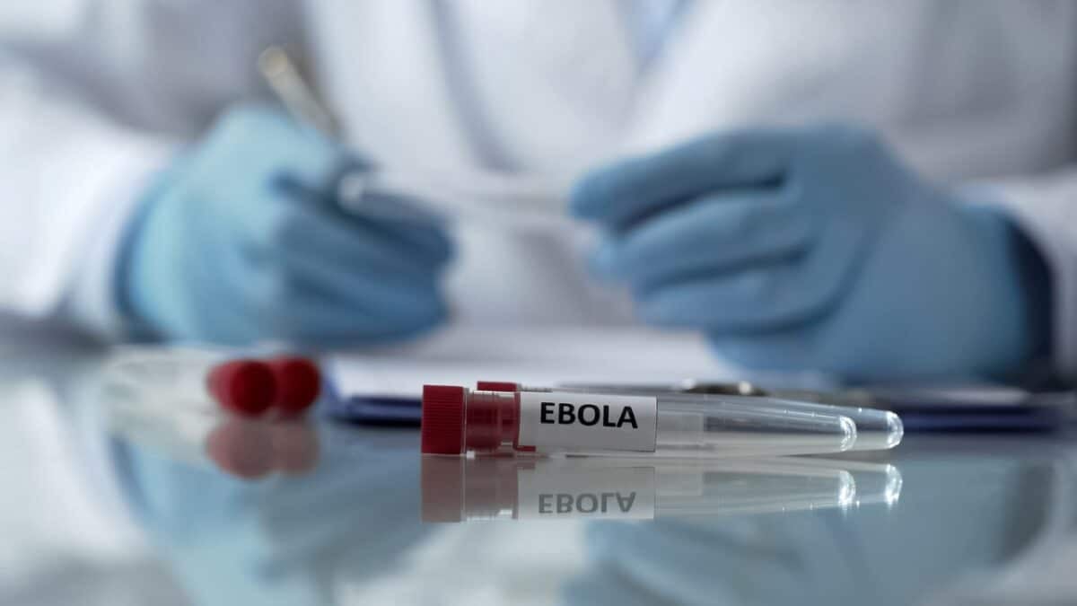 São Paulo Health Department isolates 31-year-old patient to investigate ...